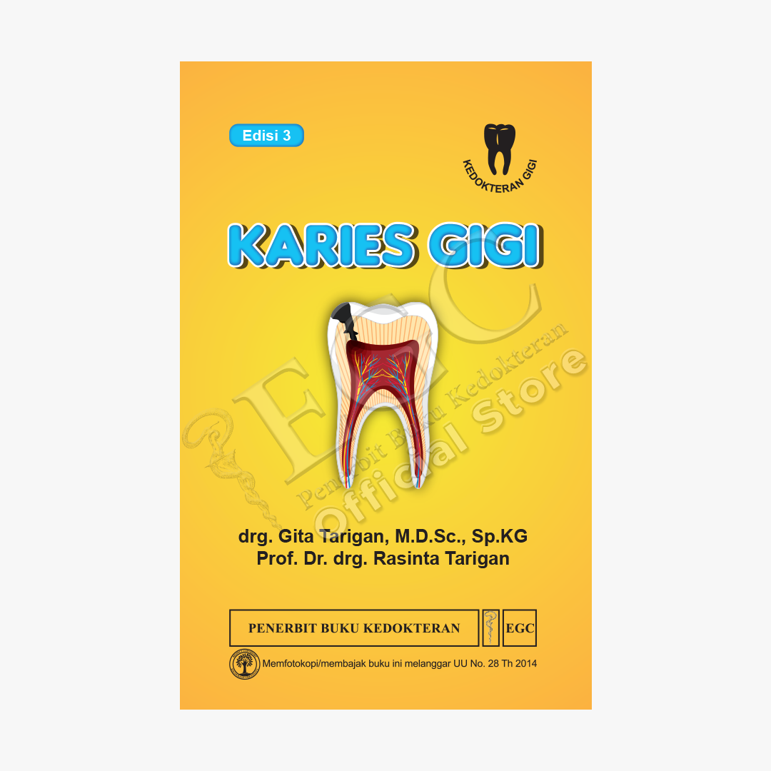 Buku Kedokteran Gigi: Buku KARIES GIGI ed.3